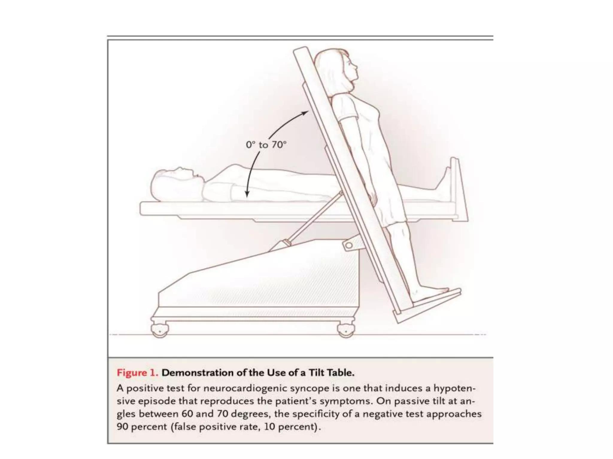 ORTHOSTATIC HYPOTENSION | PPTX