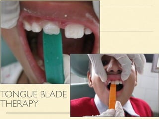 ortho management of crossbite | PPT