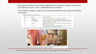 6 PACIENTE QUEMADO.pptx