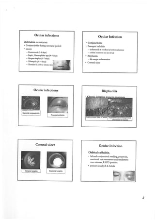Paediatric ophthalmology | PDF