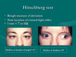 Common problems in paediatric ophthalmology | PPT