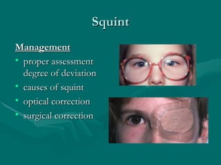 Common problems in paediatric ophthalmology | PPT