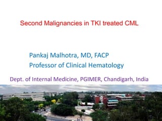 Second Malignancies in TKI treated Chronic Myeloid Leukemia | PPTX