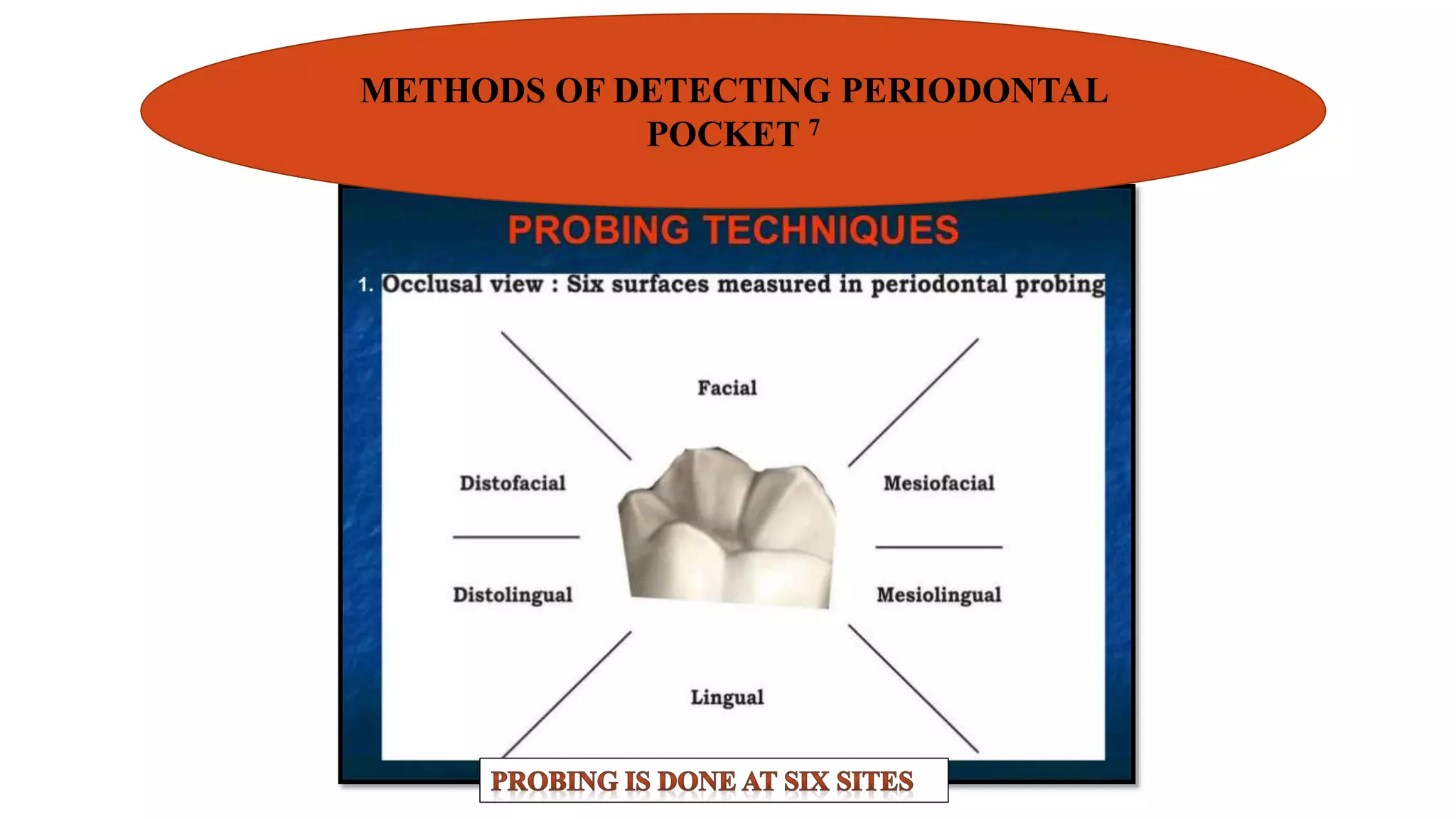 perioDONTAL pocket | PPTX