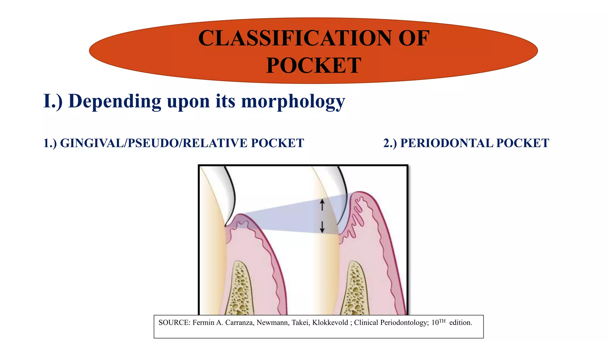 perioDONTAL pocket | PPTX