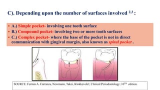 perioDONTAL pocket | PPTX