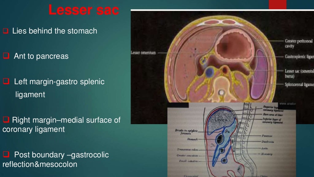 Peritoneum Anatomy And Pathology Part 1 peritoneum-anatomy-and-pathology-part-1