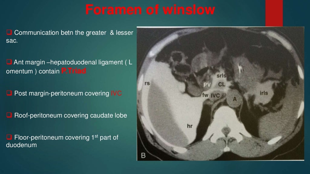 Peritoneum Anatomy and pathology part 1