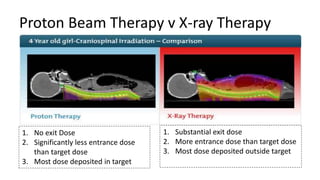 Professor Mark Glaser (Imperial College London). Proton Therapy in the ...