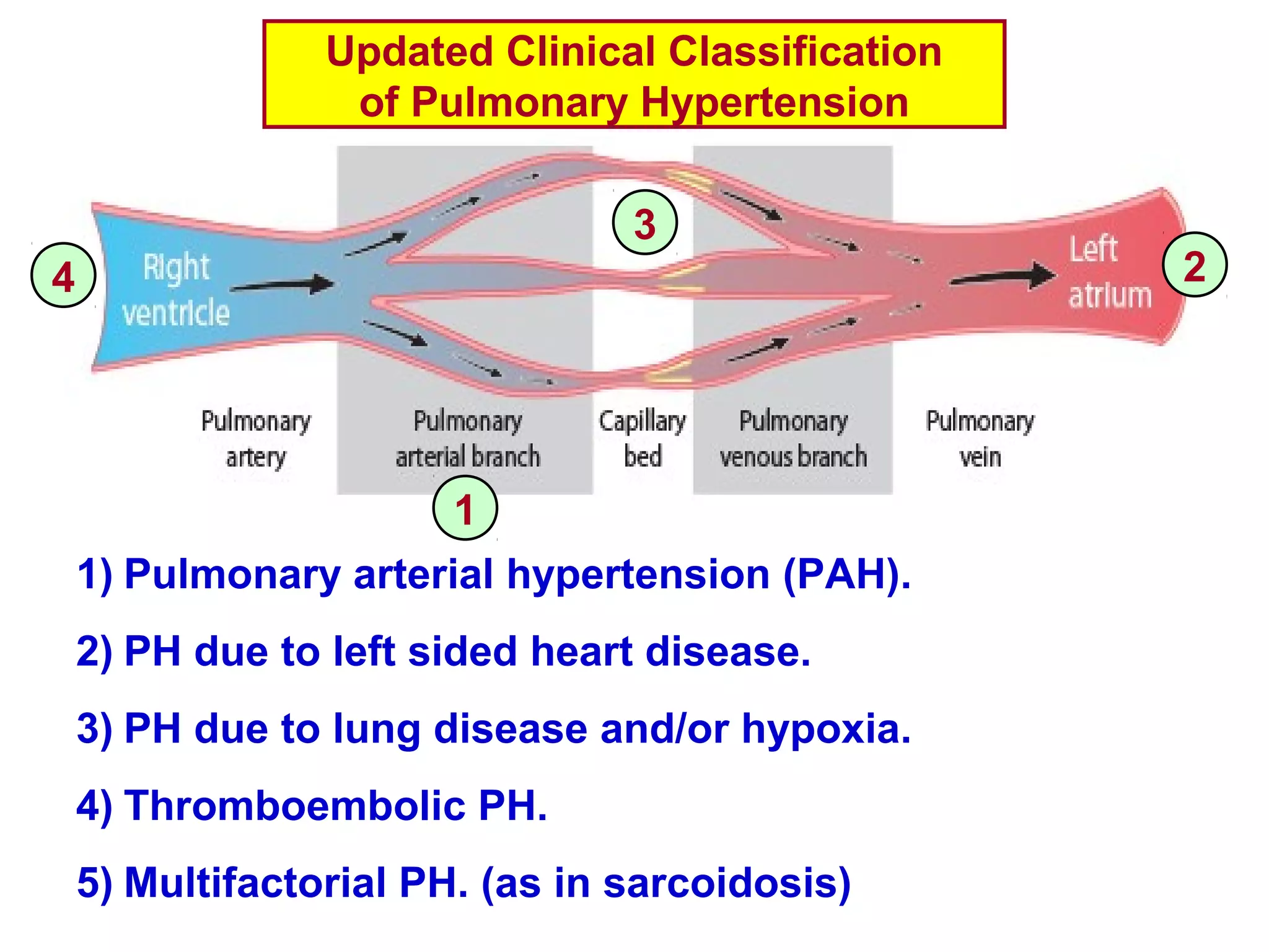 6 pulmonary hypertension | PPT