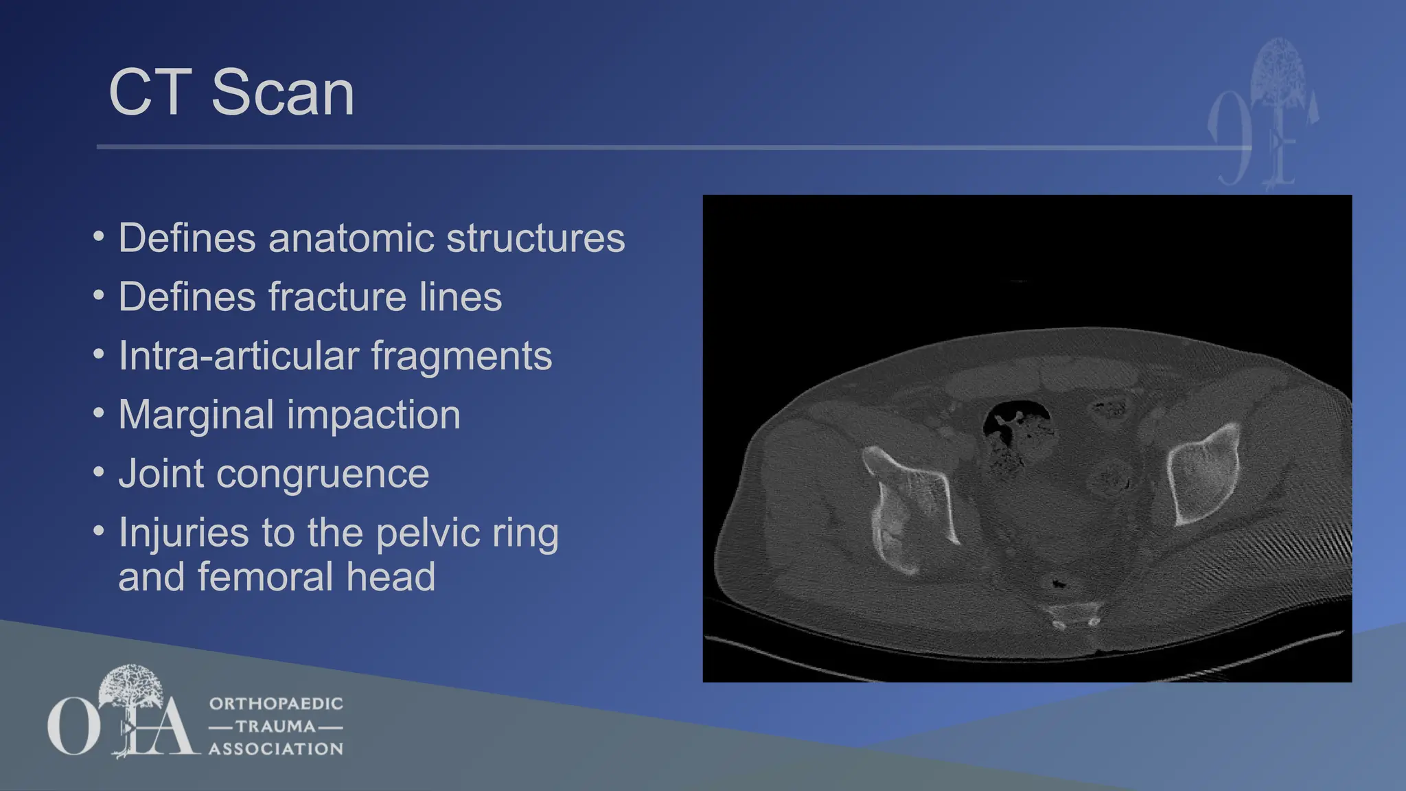 6_Radiographic Understanding, Evaluation & Classification of Acetabular ...