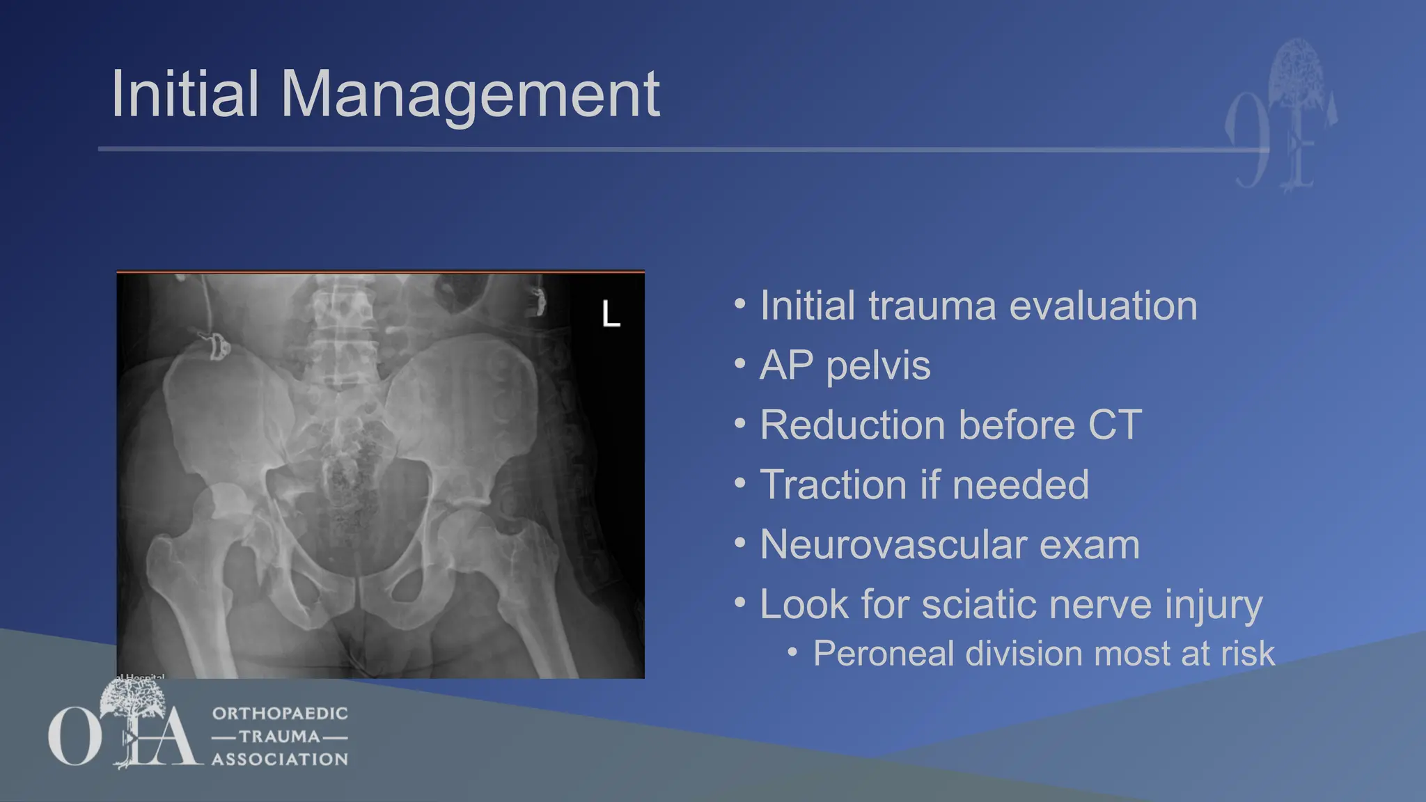 6_Radiographic Understanding, Evaluation & Classification of Acetabular ...
