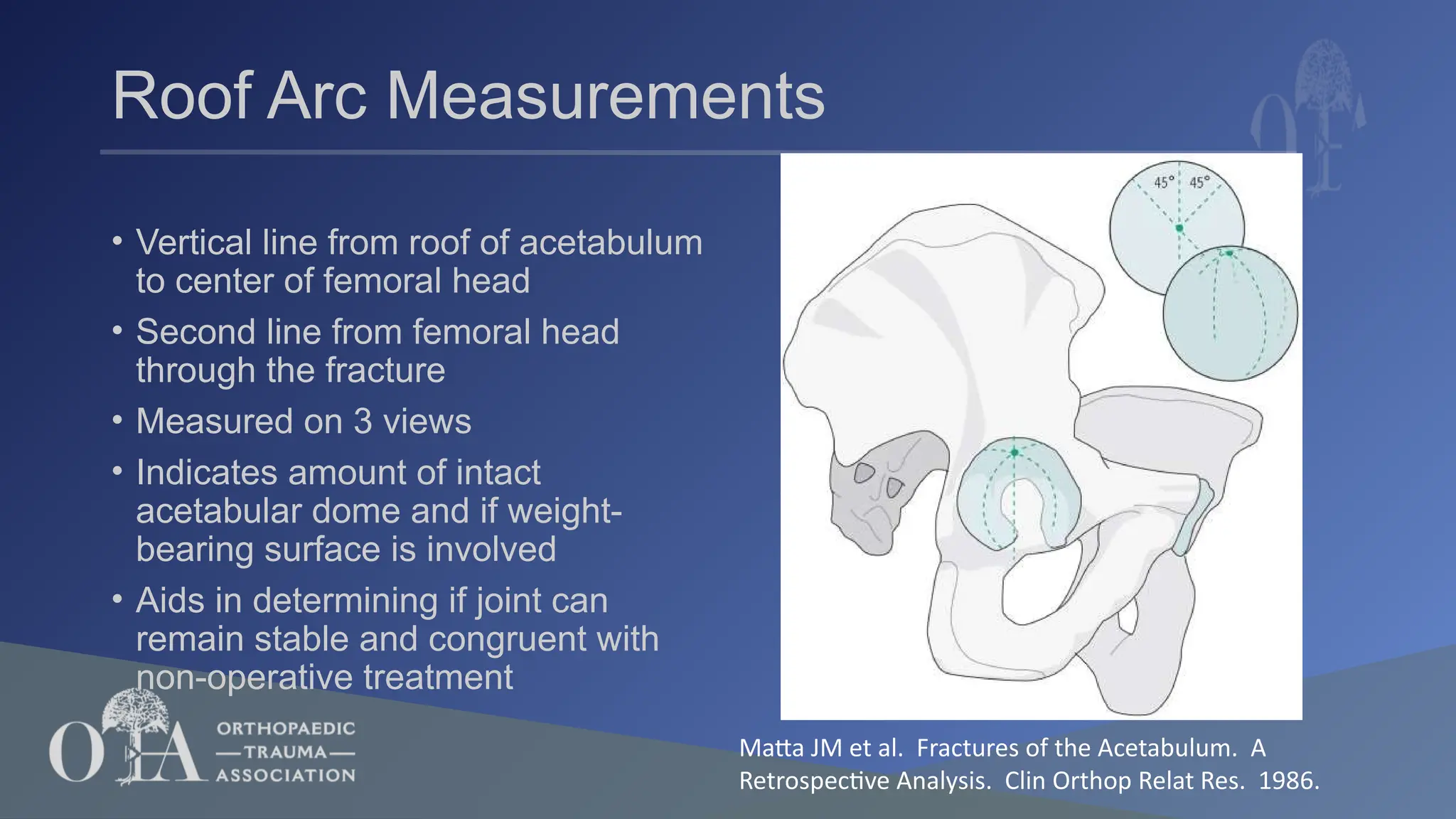 6_Radiographic Understanding, Evaluation & Classification of Acetabular ...