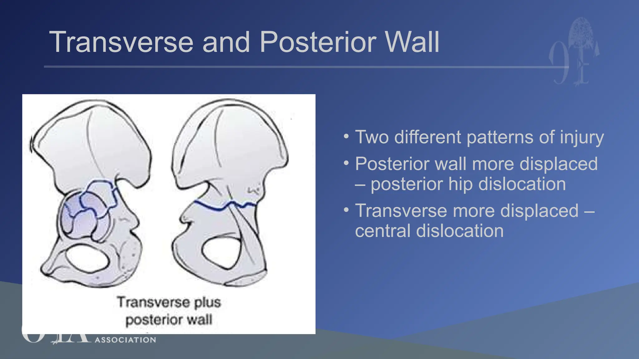 6_Radiographic Understanding, Evaluation & Classification of Acetabular ...