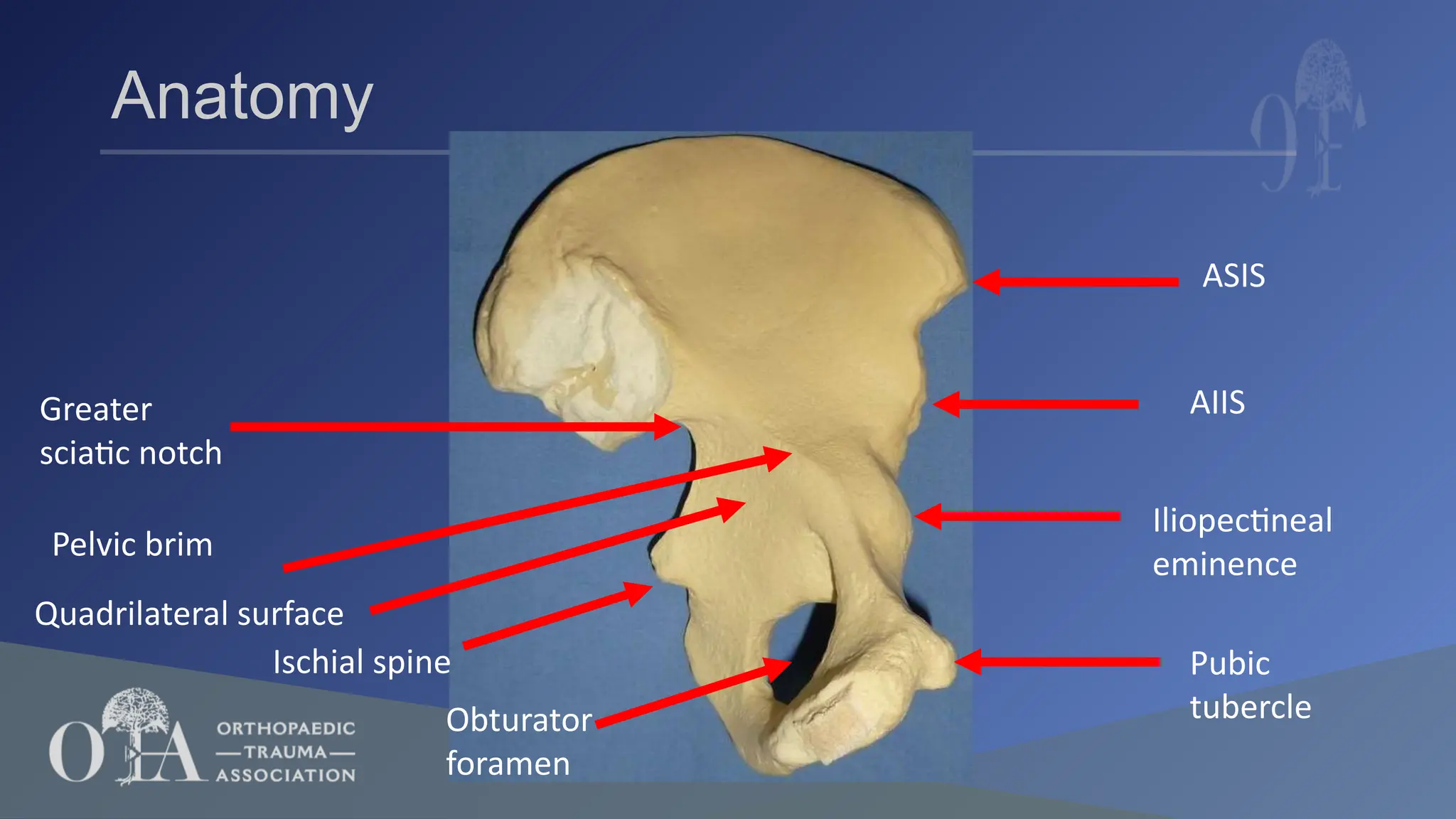 6_Radiographic Understanding, Evaluation & Classification of Acetabular ...