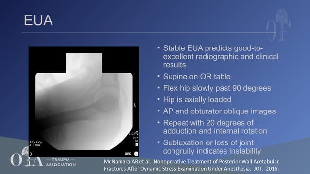 6_Radiographic Understanding, Evaluation & Classification of Acetabular ...