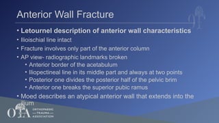 6_Radiographic Understanding, Evaluation & Classification of Acetabular ...