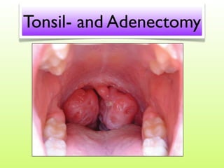 6 rcio spreecast int ortho | PDF