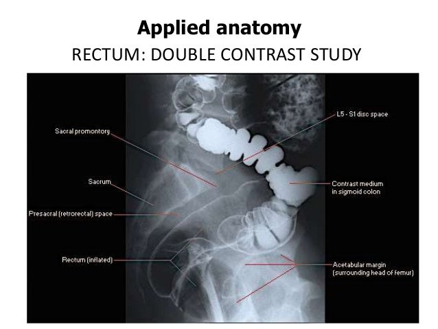 Anatomy of Rectum