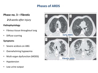 6) respiratory failure.pptx