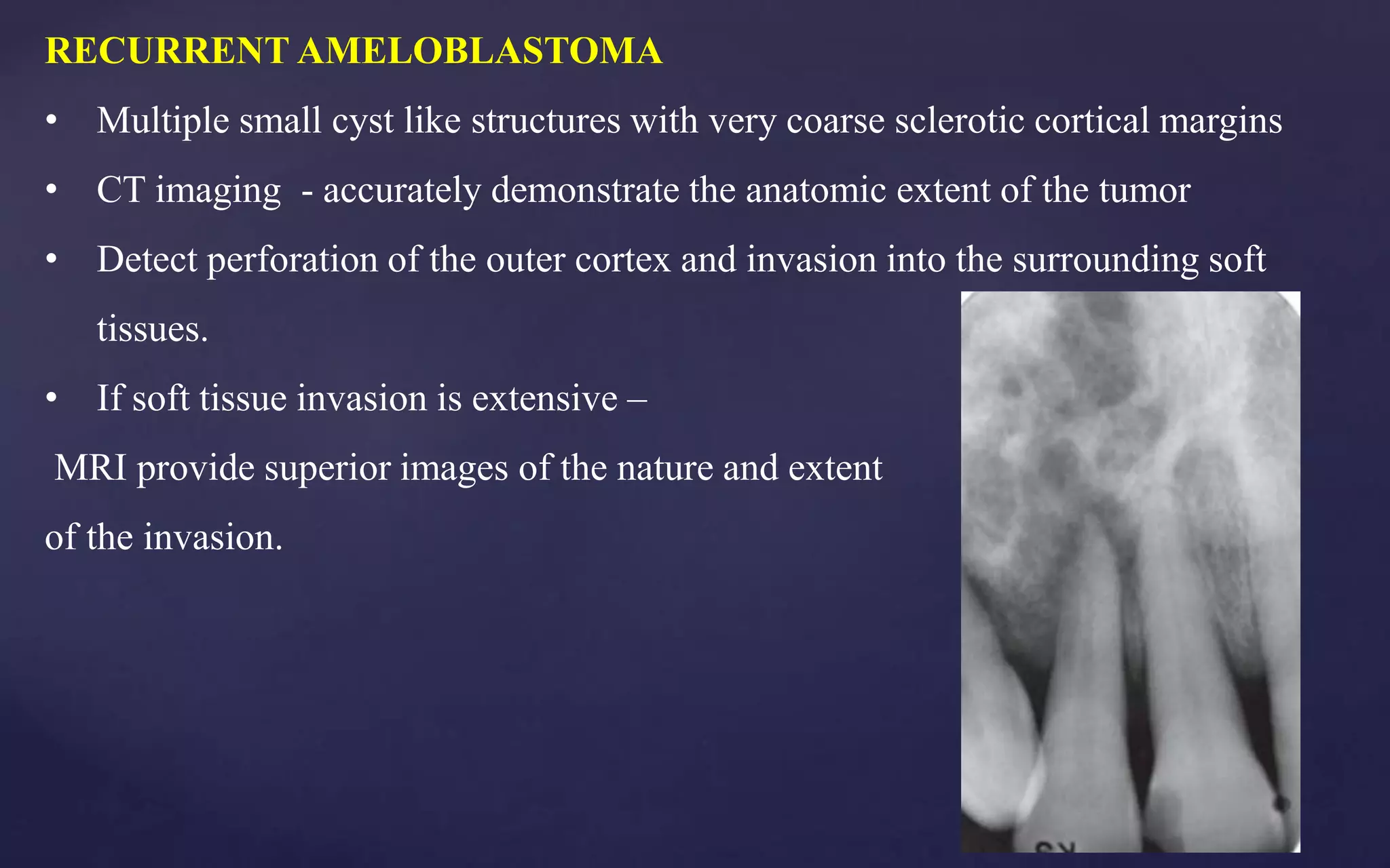 RADIOGRAPHIC FEATURES OF TUMORS OF JAWS | PPTX