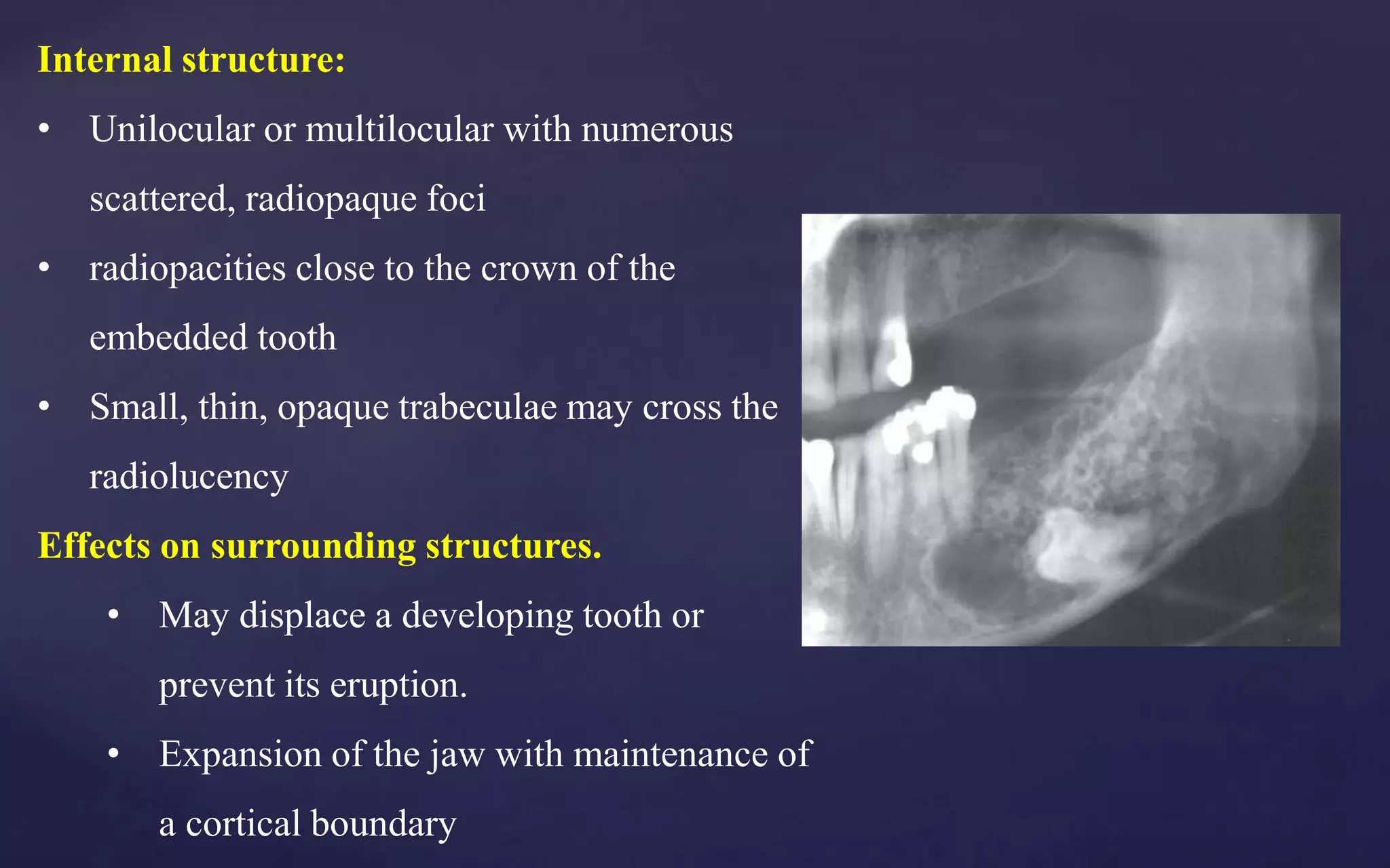 RADIOGRAPHIC FEATURES OF TUMORS OF JAWS | PPTX