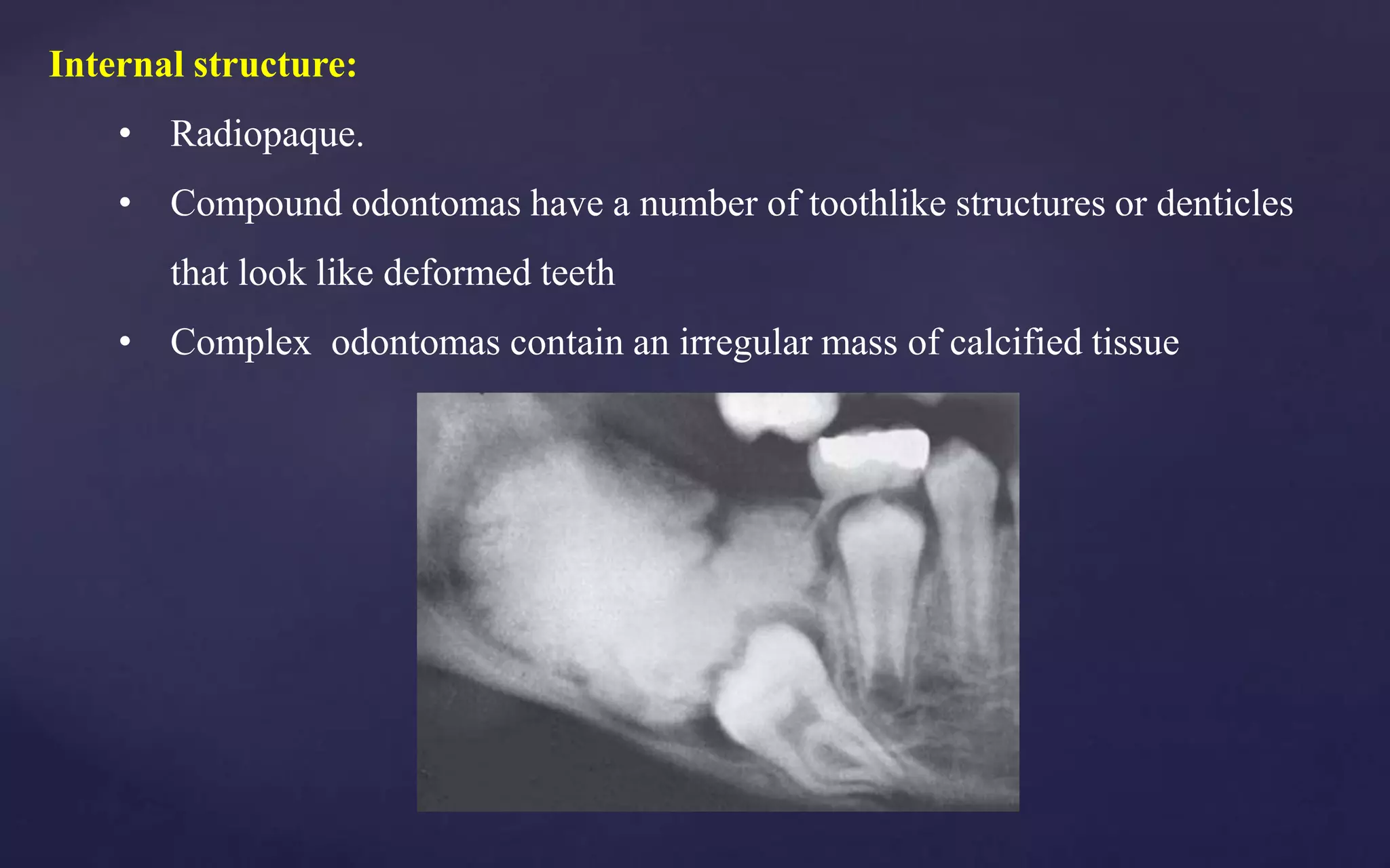 RADIOGRAPHIC FEATURES OF TUMORS OF JAWS | PPTX