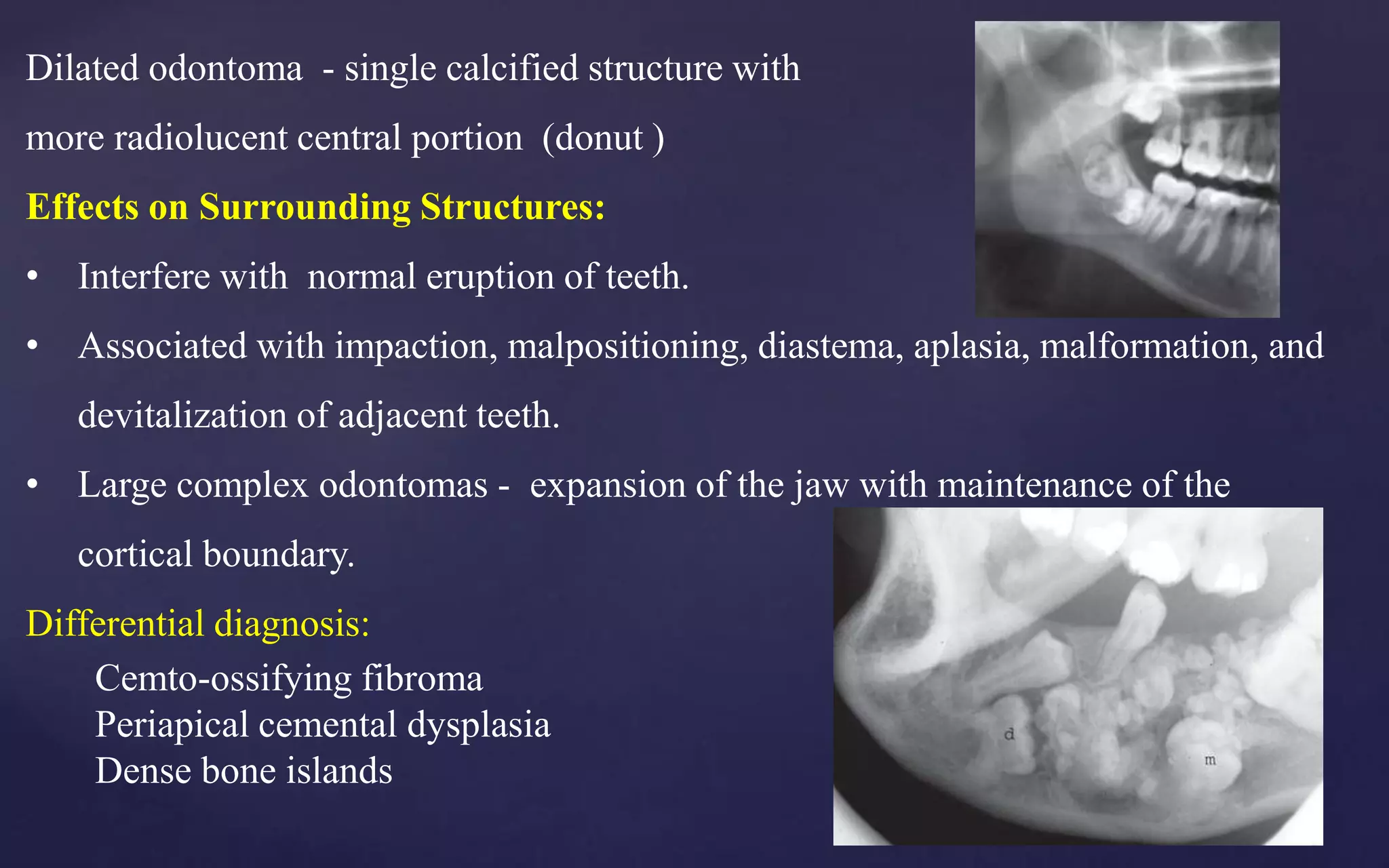 RADIOGRAPHIC FEATURES OF TUMORS OF JAWS | PPTX