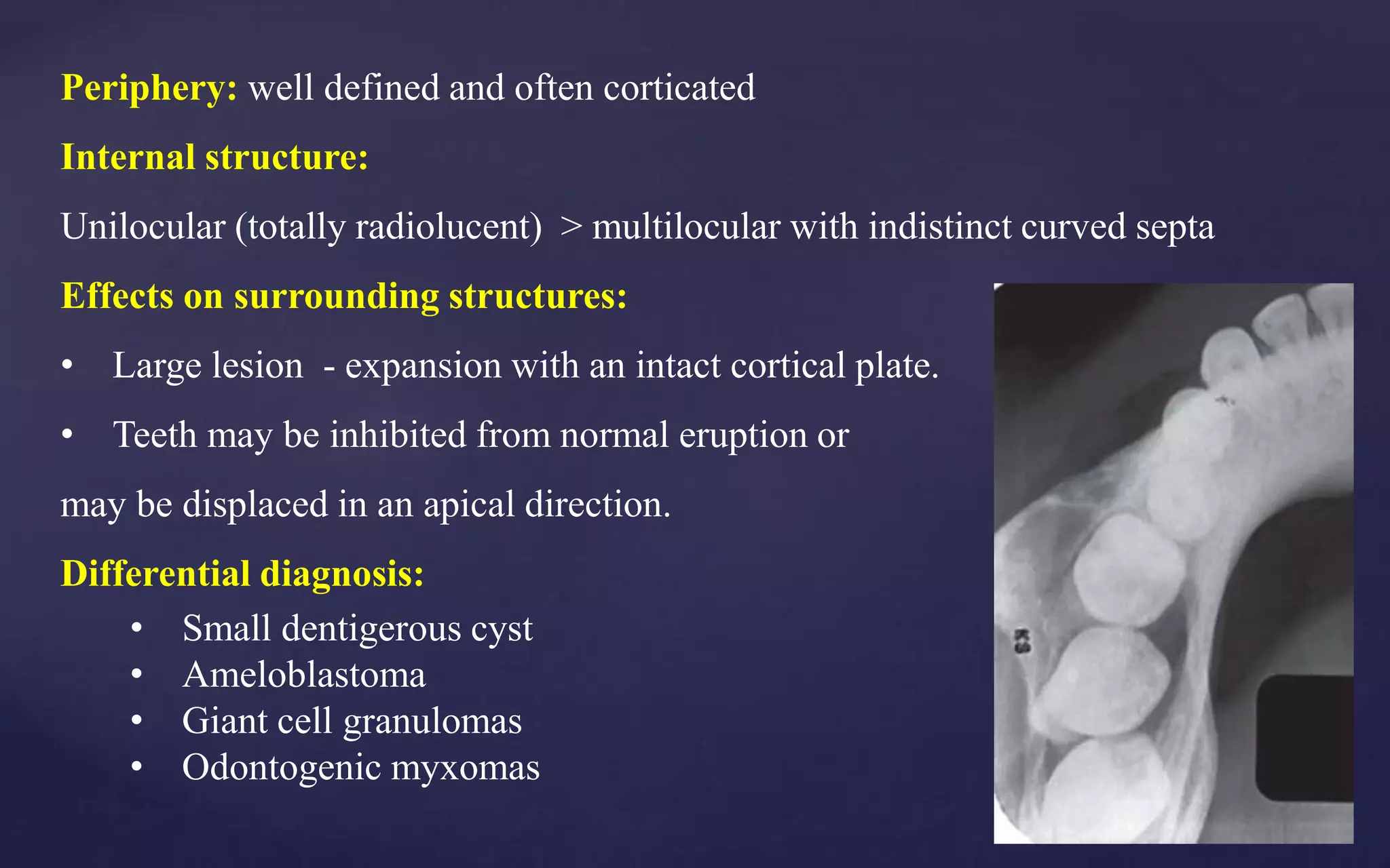 RADIOGRAPHIC FEATURES OF TUMORS OF JAWS | PPTX