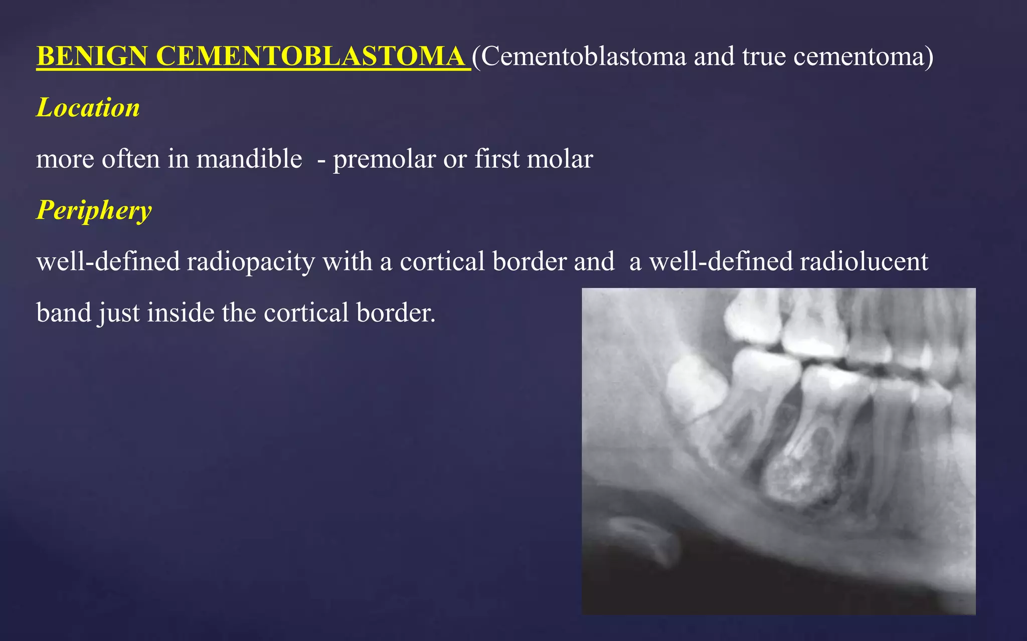 RADIOGRAPHIC FEATURES OF TUMORS OF JAWS | PPTX