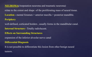 RADIOGRAPHIC FEATURES OF TUMORS OF JAWS | PPTX