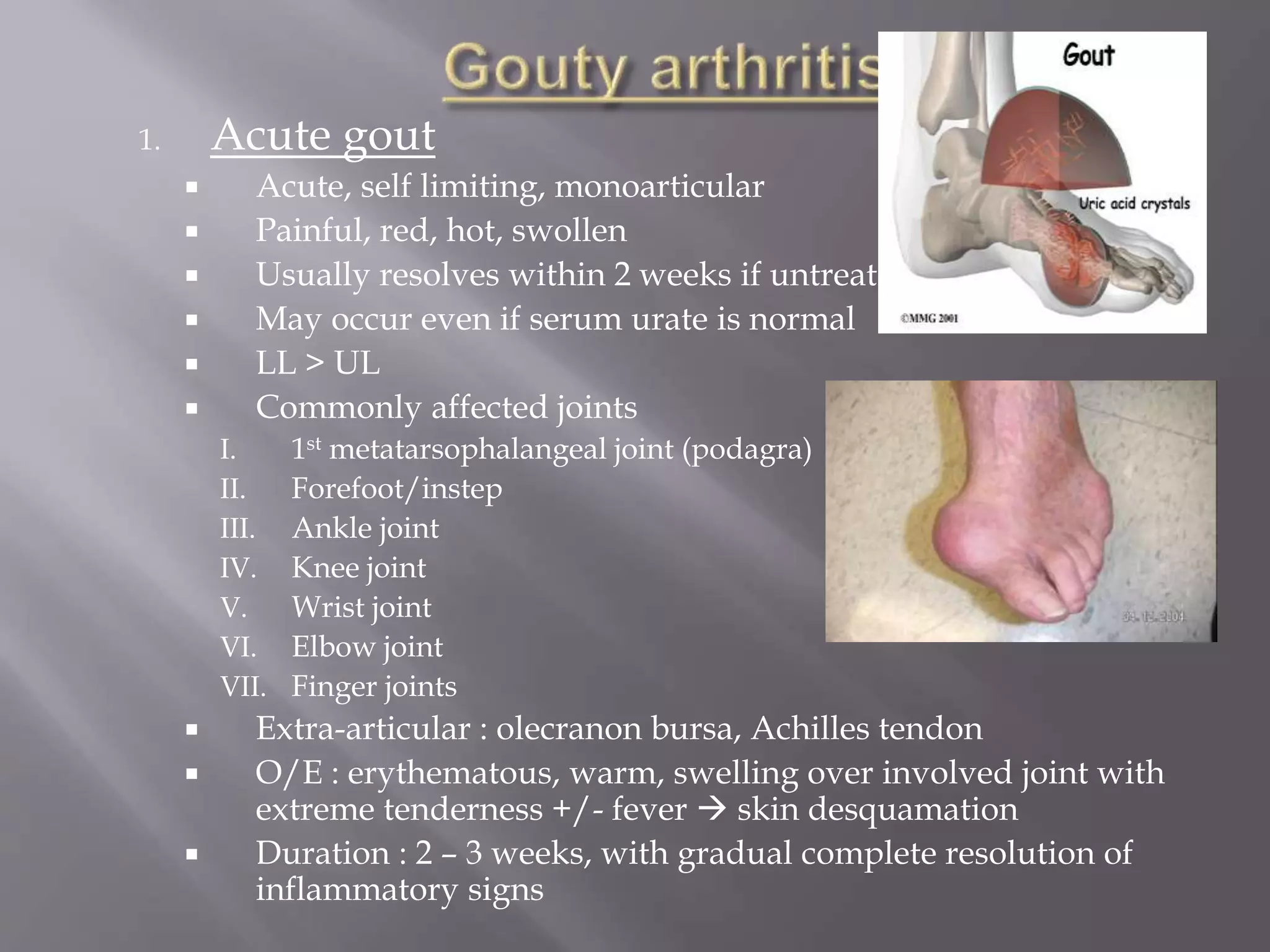 rheumatoid arthritis,gout & osteoarthritis | PPTX