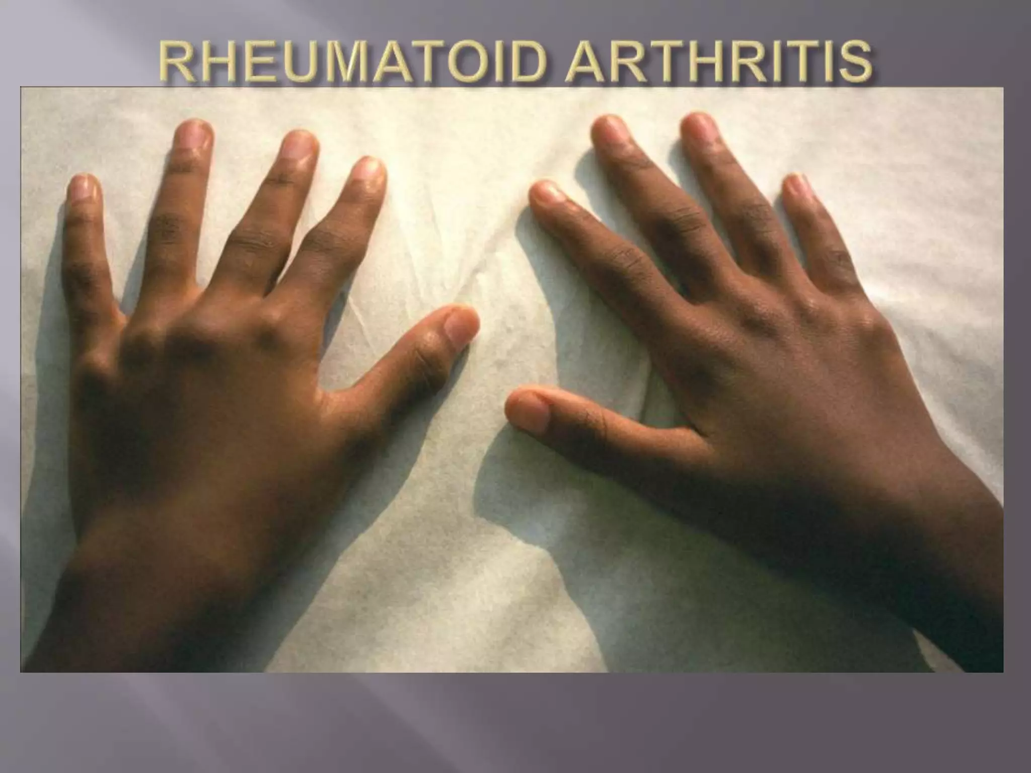 rheumatoid arthritis,gout & osteoarthritis | PPTX