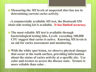 13 the white spot lesion | PPTX