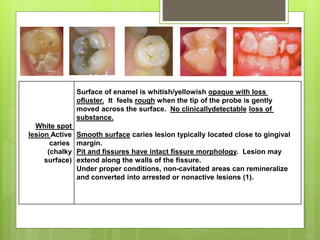 13 the white spot lesion | PPTX