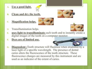 13 the white spot lesion | PPTX