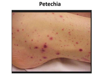 Final oral mucosal lesions | PPT