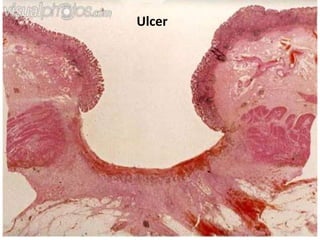 Final oral mucosal lesions | PPT