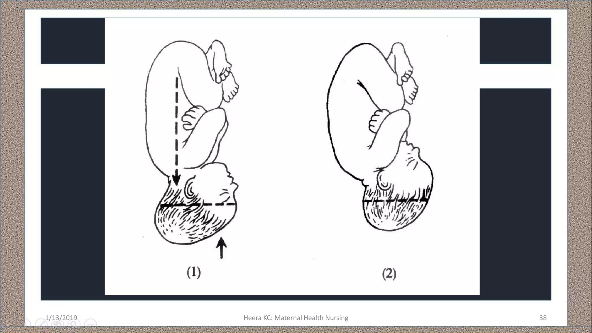 Mechanism of labour | PPTX