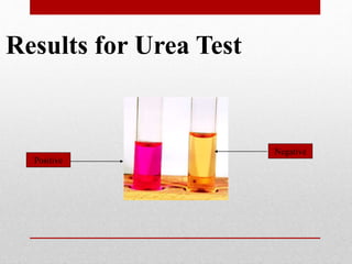 6th lab 2nd part biochemical tests | PPT