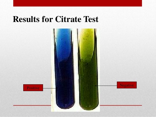 6th lab 2nd part biochemical tests