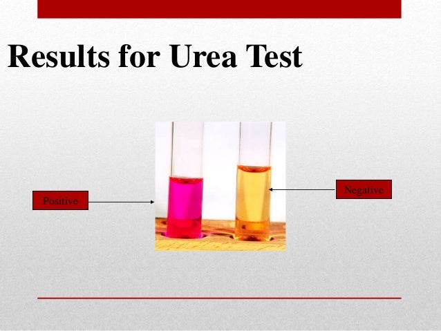 6th lab 2nd part biochemical tests