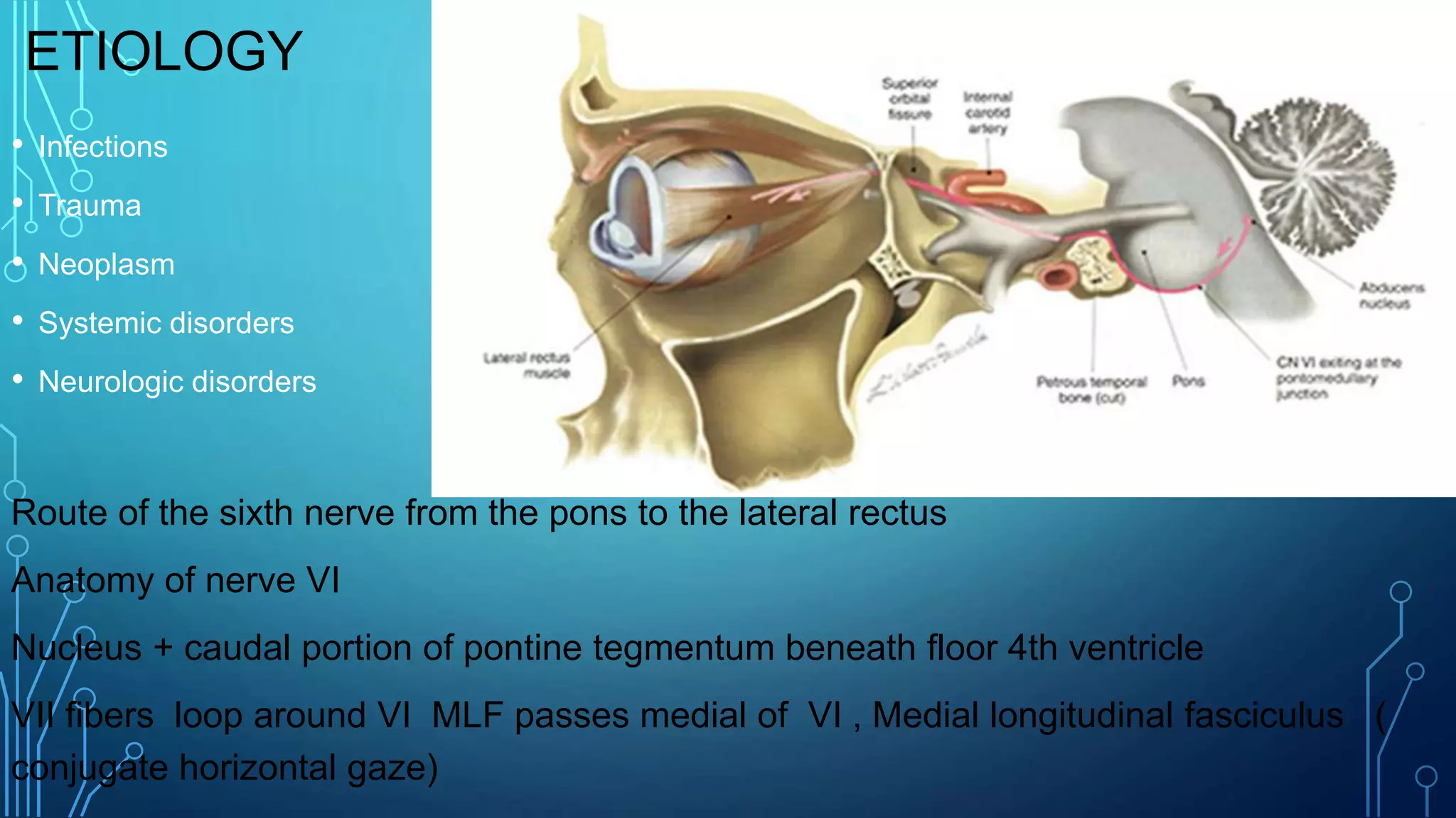 6 Th Nerve Palsy Pptx