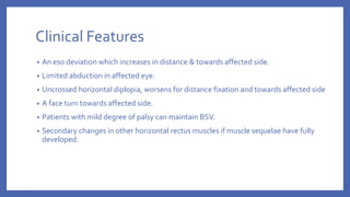 6th Nerve Palsy | PPTX