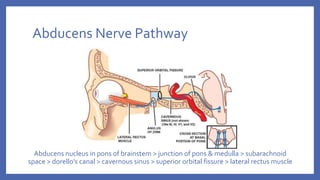 6th Nerve Palsy | PPTX