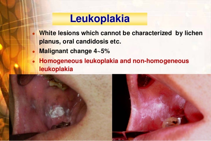 oral mucosal diseases 2010