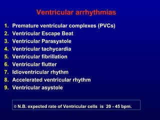6th part ECG BASICs: ventricular arrhythmias Dr Salah Mabrouk Khallaf | PPT