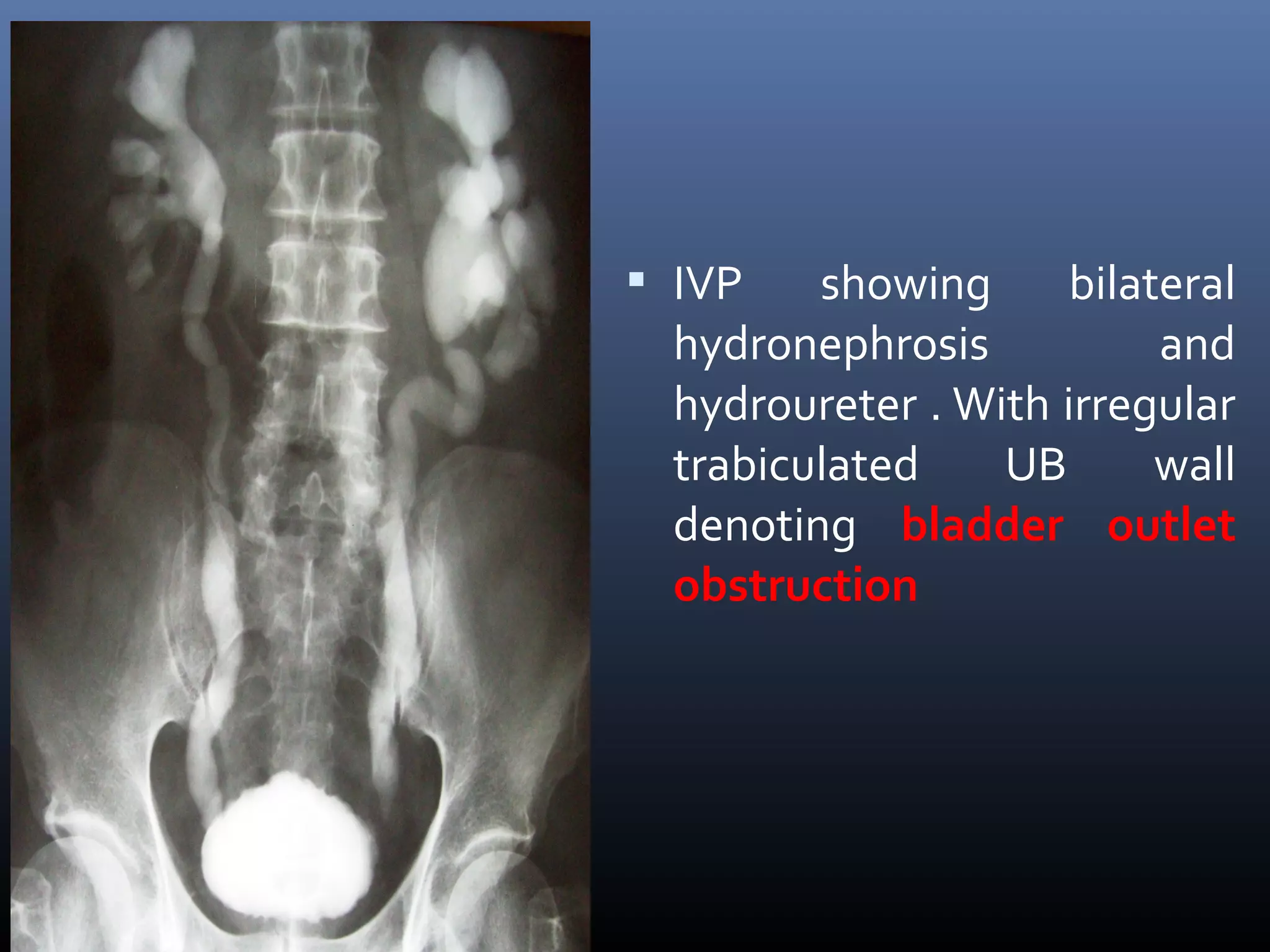 Imaging For Medical Students (Renal System) | PPT