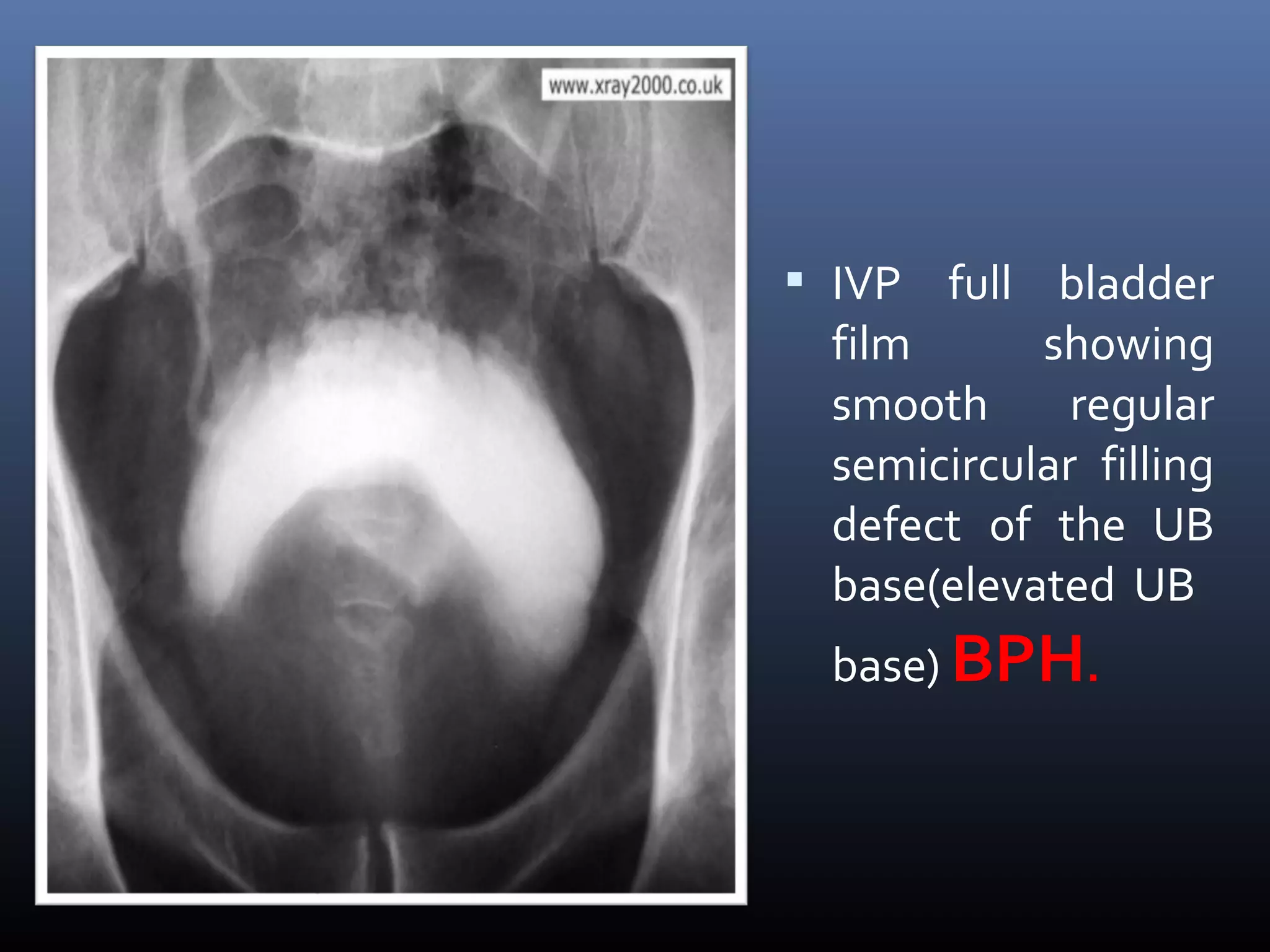 Imaging For Medical Students (Renal System) | PPT