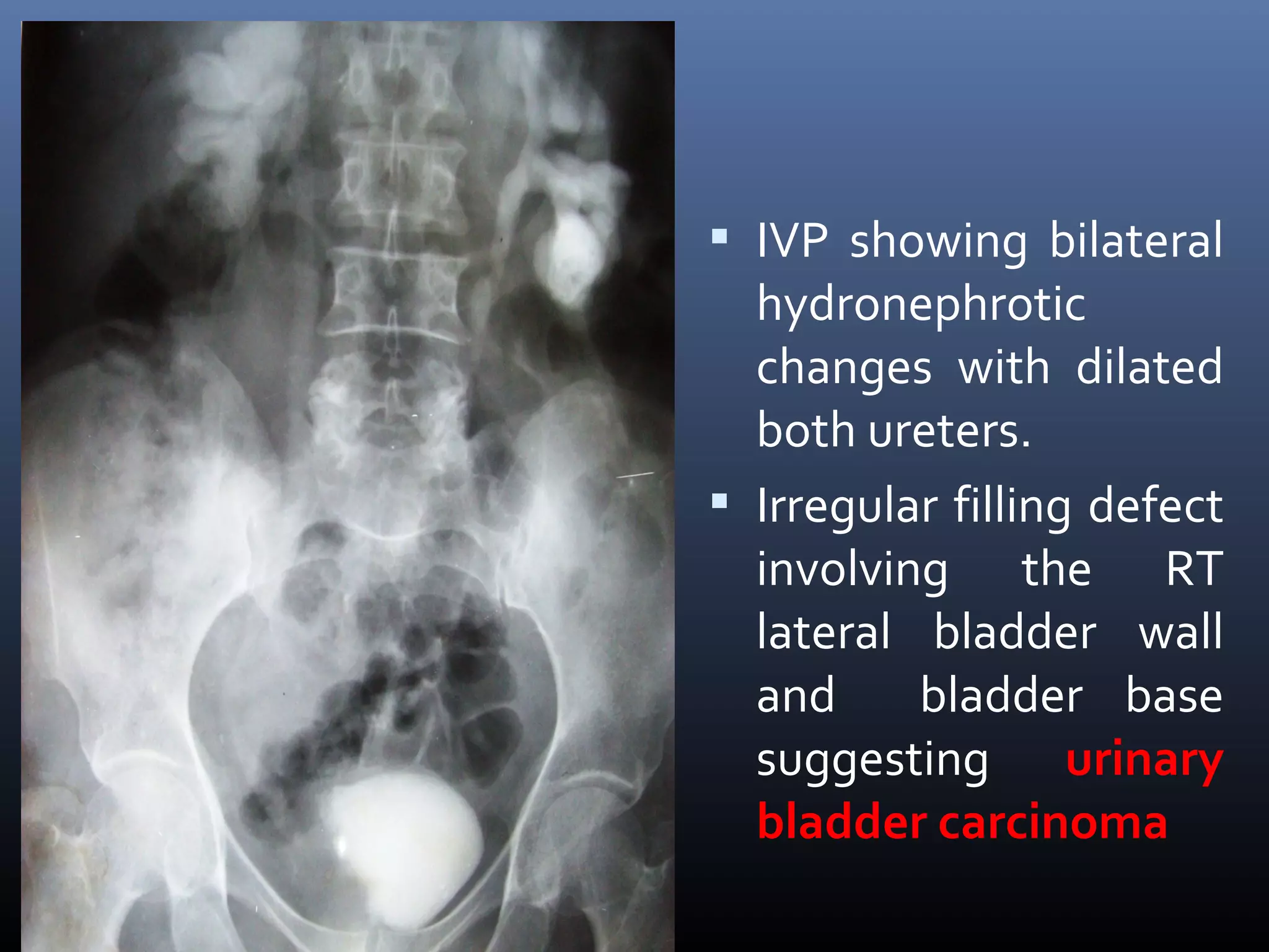 Imaging For Medical Students (Renal System) | PPT